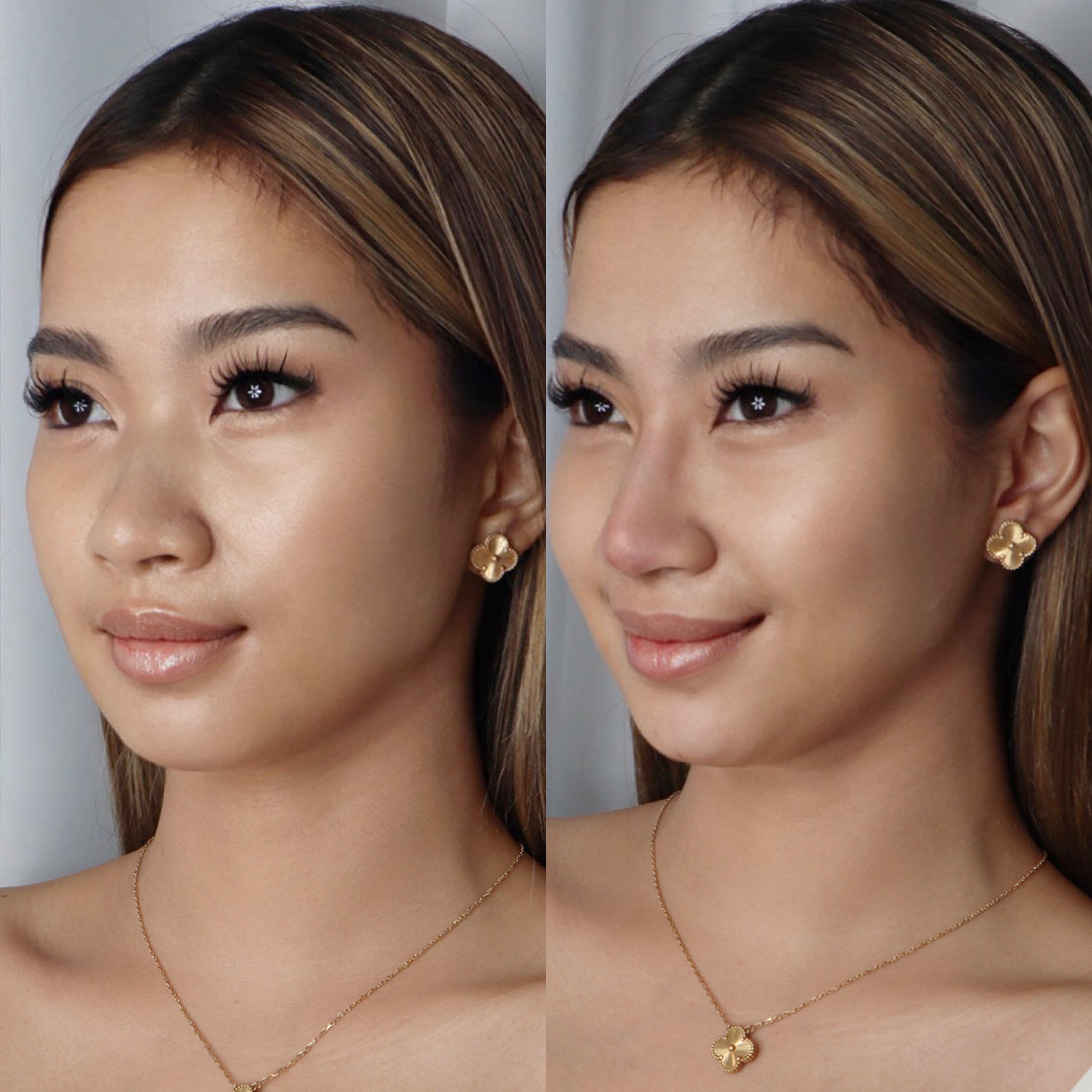 Nose Sculpture – Prettylooks Aesthetic Center