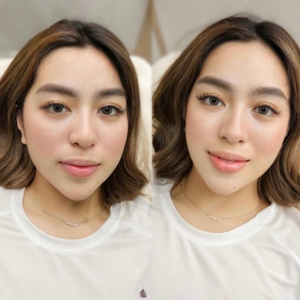 Lip Pout – Prettylooks Aesthetic Center